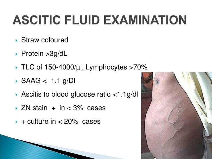 PPT - ABDOMINAL TUBERCULOSIS PowerPoint Presentation - ID:1942061