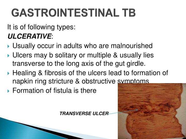 PPT - ABDOMINAL TUBERCULOSIS PowerPoint Presentation - ID:1942061