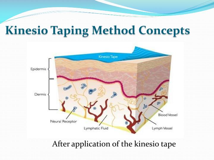 PPT - kinesio Taping PowerPoint Presentation - ID:1942309