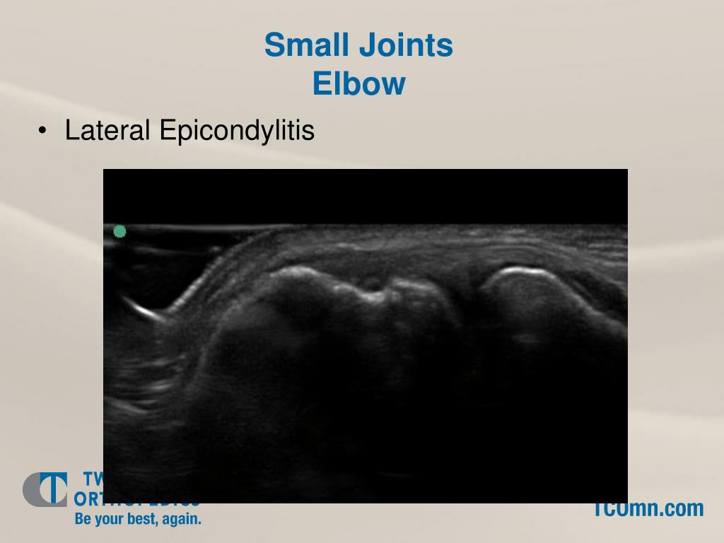PPT - Ultrasound Guided Injections in a Sports Medicine Practice ...
