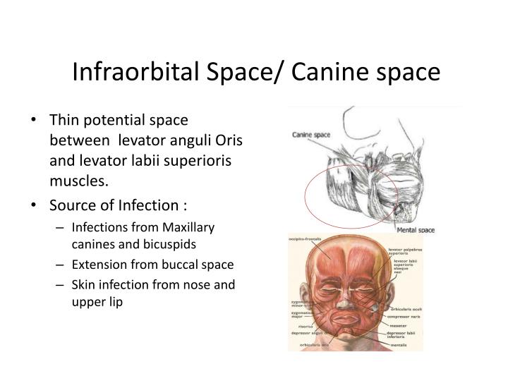 PPT - Complex Odontogenic Infections PowerPoint Presentation - ID:1944812