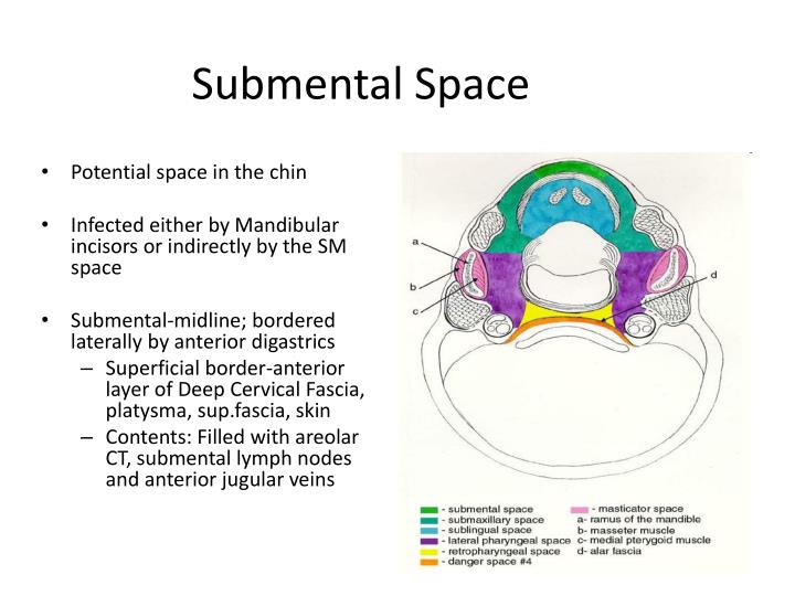 PPT - Complex Odontogenic Infections PowerPoint Presentation - ID:1944812