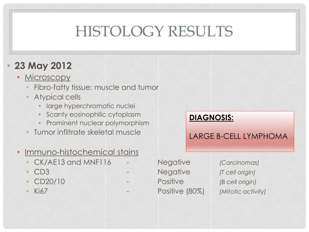 PPT - Case study: lymphoma/ granulomatous disease PowerPoint ...