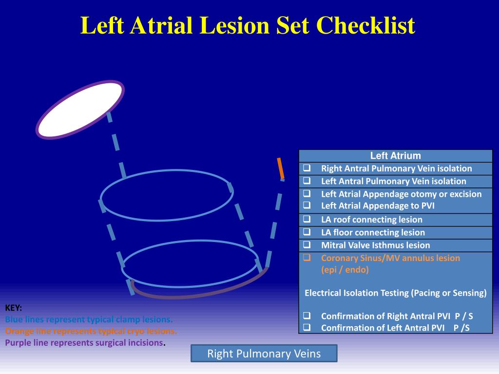 PPT - Contemporary Surgical Therapy for Atrial Fibrillation PowerPoint ...