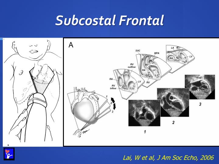 PPT - Back To Basics: Echo PowerPoint Presentation - ID:1945514