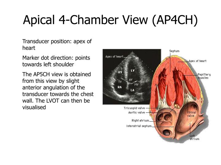 PPT - Parasternal Short Axis View (PSAX) PowerPoint Presentation - ID ...