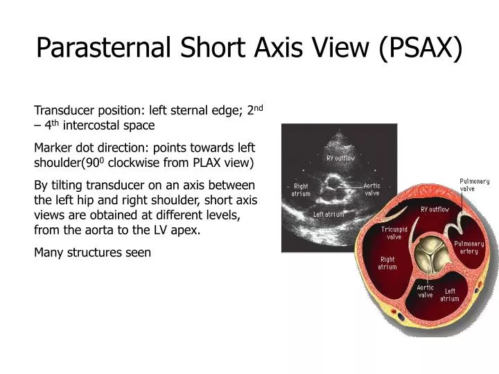 PPT - Parasternal Short Axis View (PSAX) PowerPoint Presentation, free ...