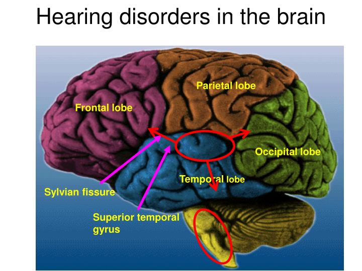 PPT - Effects of hearing loss and hearing aids on quality of life and ...