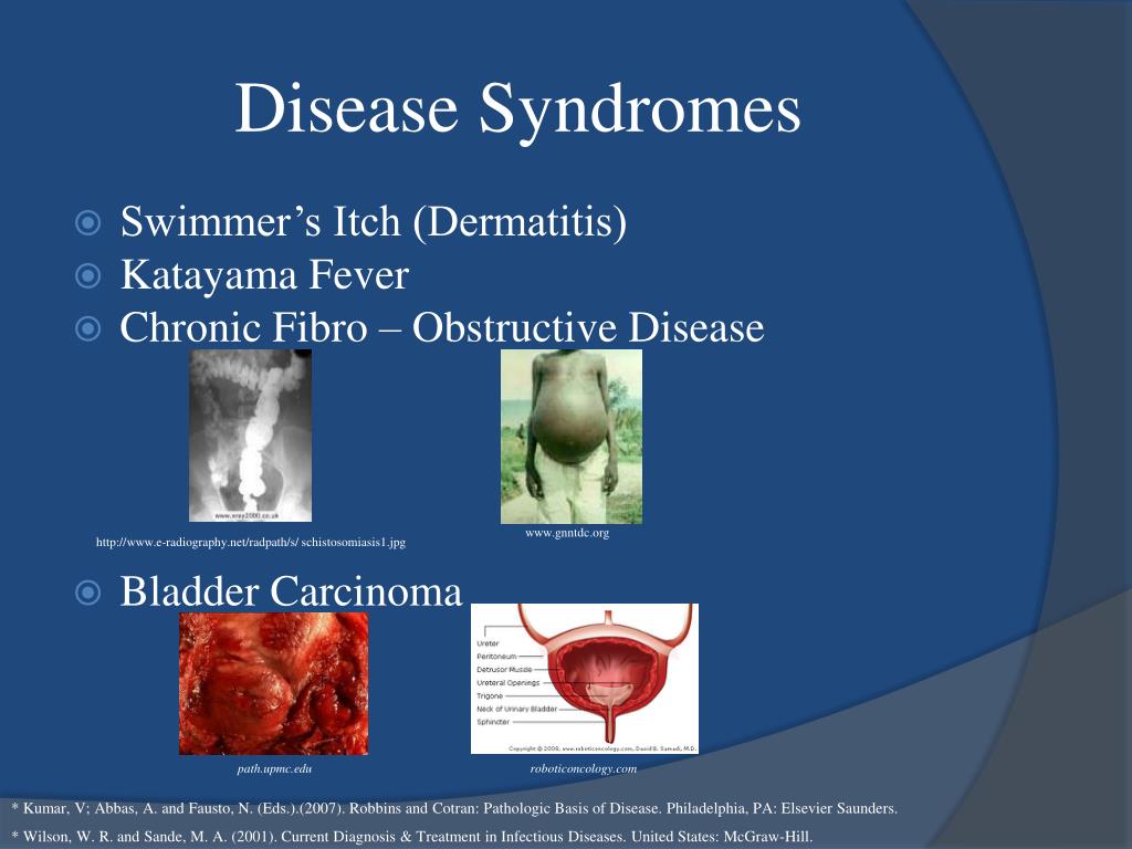 PPT - Schistosomiasis : An unfamiliar infectious disease PowerPoint ...