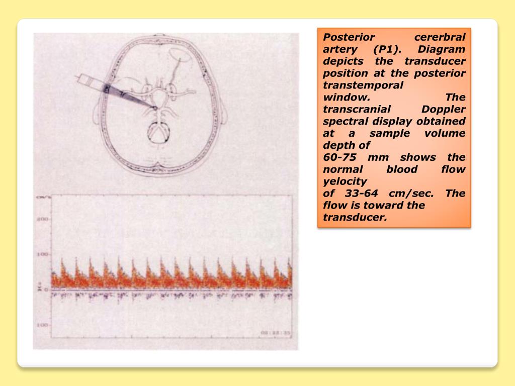 PPT - LA NEUROSONOLOGIA NELL’AMBITO DELLE NEUROSCIENZE: PowerPoint ...