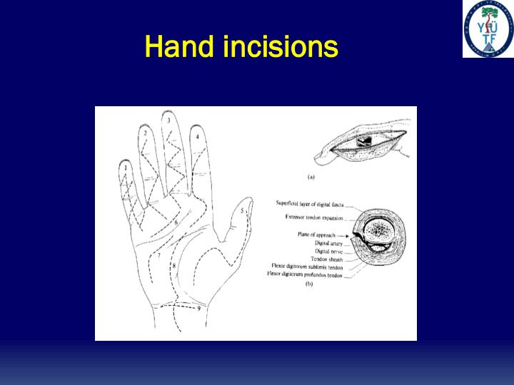 PPT - Microsurgery PowerPoint Presentation - ID:1948380
