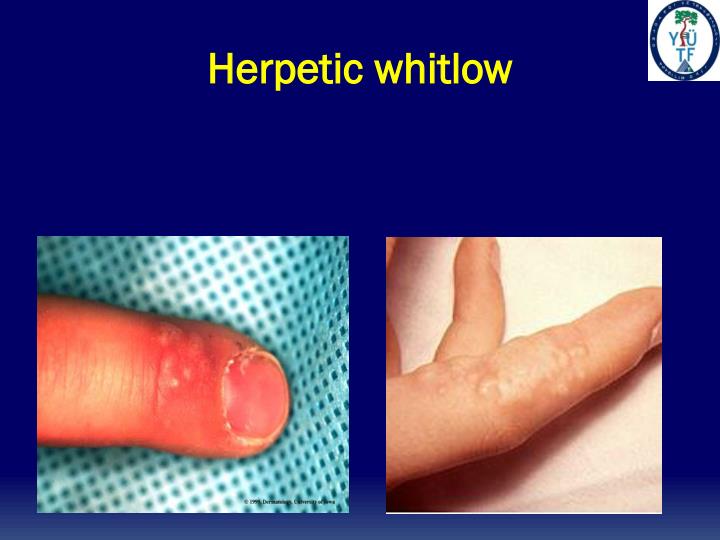 PPT - Microsurgery PowerPoint Presentation - ID:1948380