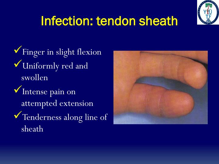 PPT - Microsurgery PowerPoint Presentation - ID:1948380