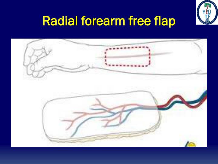 PPT - Microsurgery PowerPoint Presentation - ID:1948380