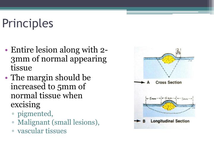 PPT - Principles of Differential diagnosis and BIOPSY PowerPoint ...