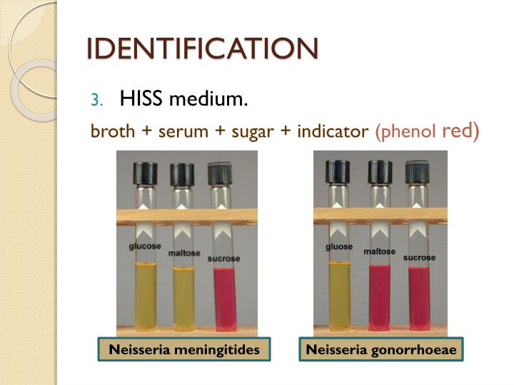 PPT - GENUS: NEISSERIA PowerPoint Presentation - ID:1951908
