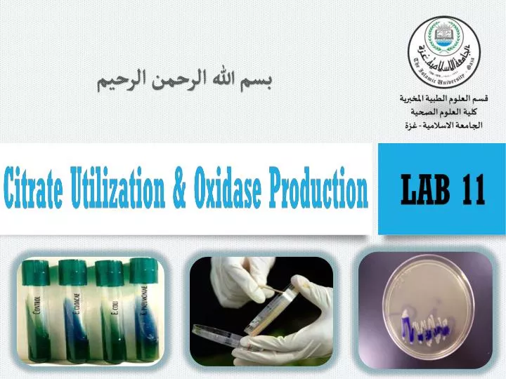 PPT - Citrate Utilization PowerPoint Presentation, free download - ID ...