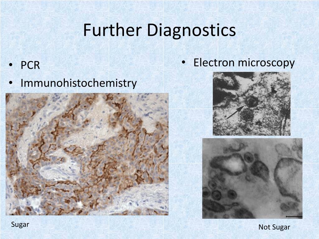 PPT - Sugar Furr Acc 142056 Enzootic Nasal Adenocarcinoma of Small ...