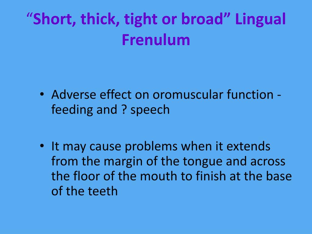 Ppt Impact On Breastfeeding Of Restrictive Lingual Frenulum
