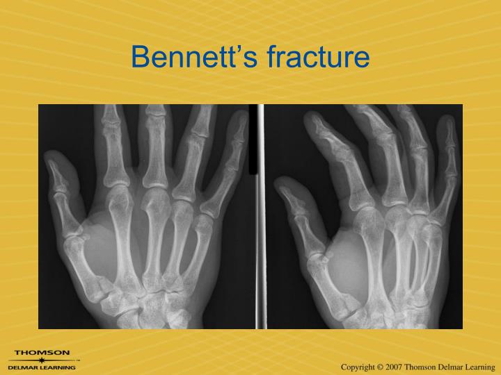 PPT - Chapter 14 PowerPoint Presentation - ID:1953337