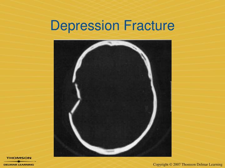 PPT - Chapter 14 PowerPoint Presentation - ID:1953337