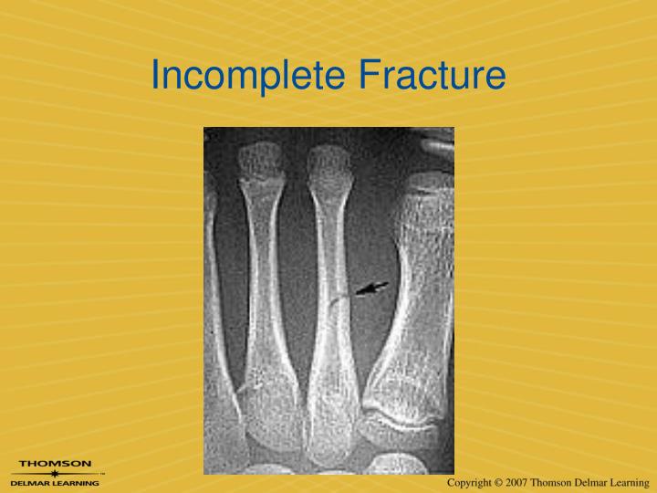 PPT - Chapter 14 PowerPoint Presentation - ID:1953337