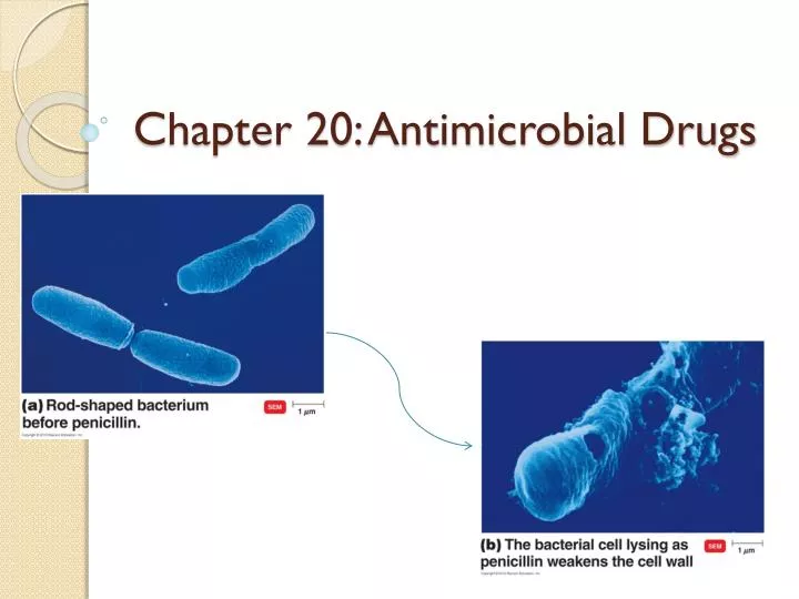 PPT - Chapter 20: Antimicrobial Drugs PowerPoint Presentation, free ...