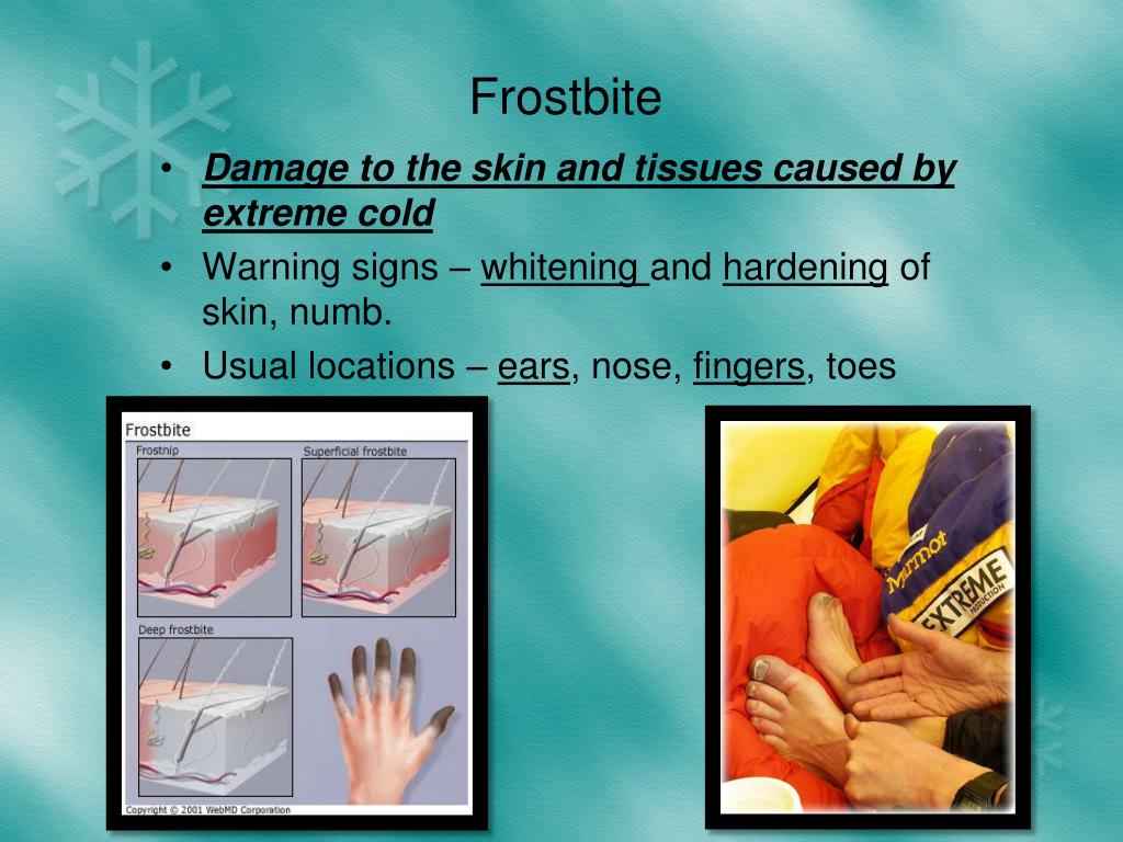 PPT - FIRST AID Hot and Cold Weather Emergencies PowerPoint ...