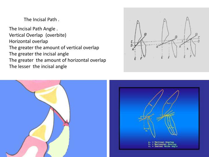 PPT - Mandibular Movements PowerPoint Presentation - ID:1960453