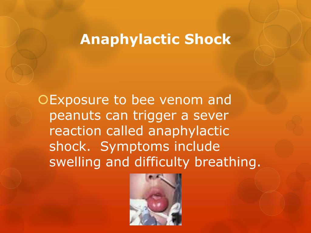 PPT - The Immune System Protects The Human Body 3.1 PowerPoint ...