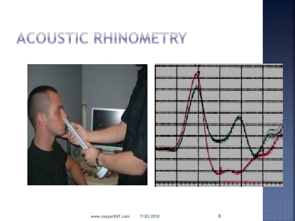 PPT - Rhinomanometry / Acoustic rhinometry – role in nasal obstruction ...