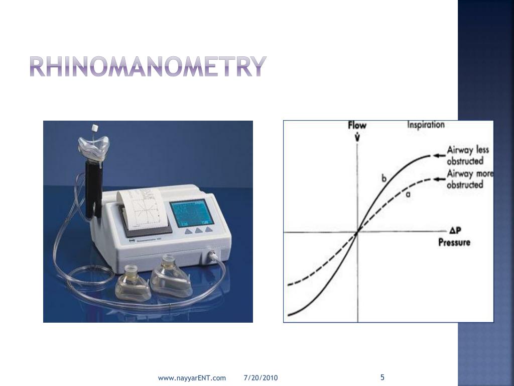 PPT - Rhinomanometry / Acoustic rhinometry – role in nasal obstruction ...