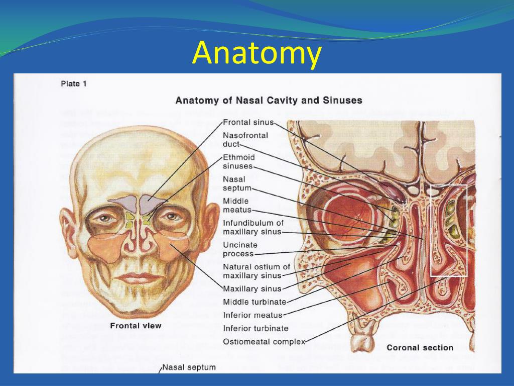 PPT - Sinusitis : Assessment, Diagnosis and Treatment Sometimes It I s ...