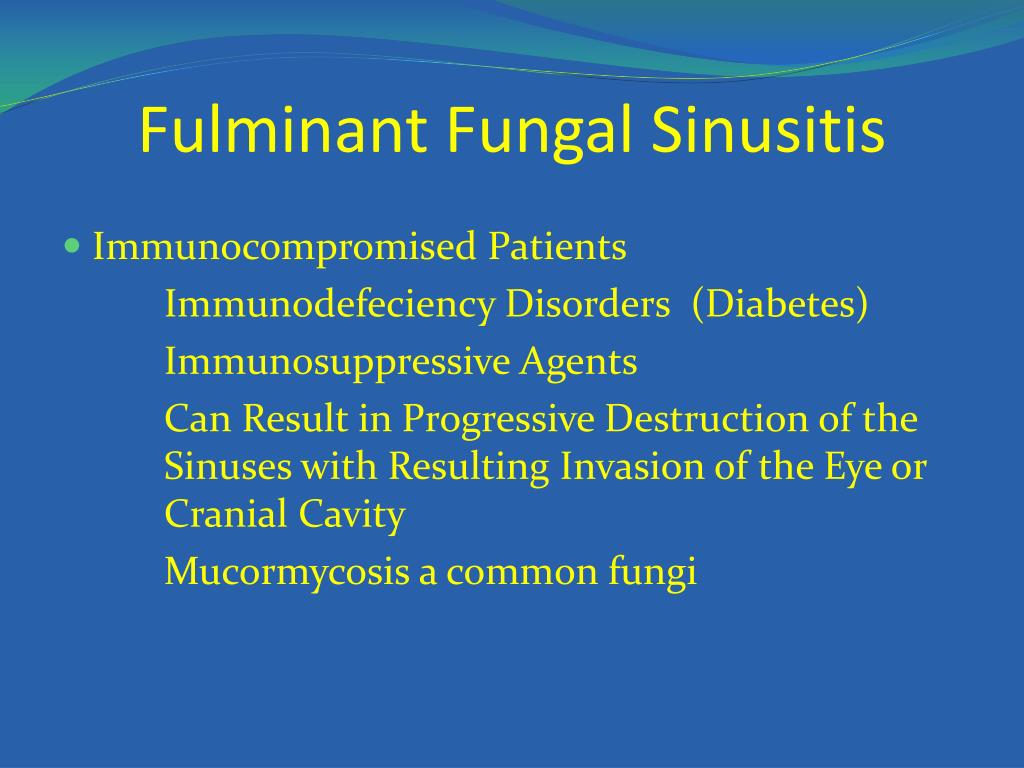 PPT - Sinusitis : Assessment, Diagnosis and Treatment Sometimes It I s ...