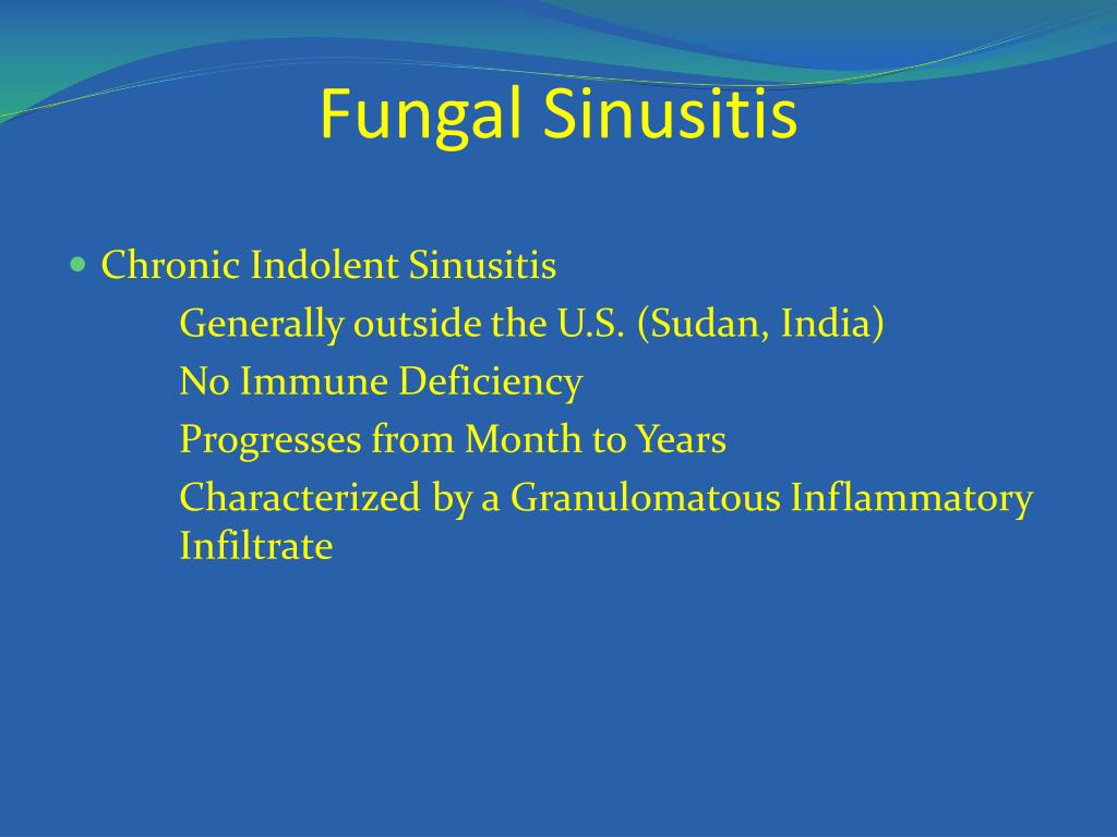 PPT - Sinusitis : Assessment, Diagnosis and Treatment Sometimes It I s ...