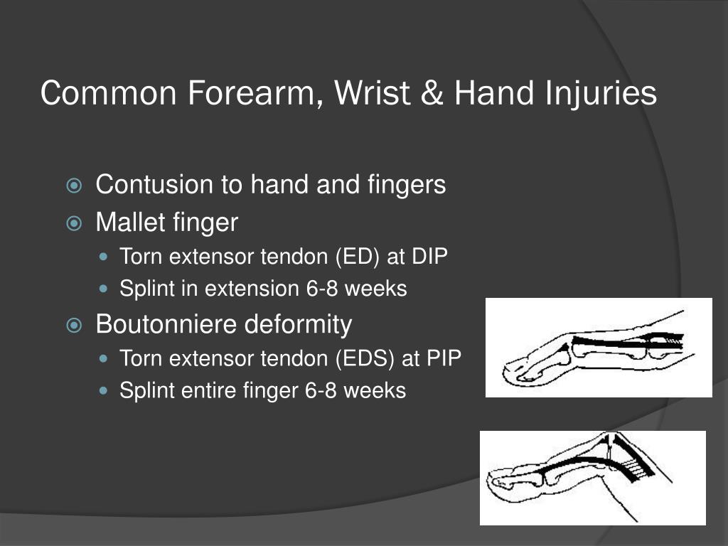 Ppt Forearm Wrist And Hand Evaluation Powerpoint Presentation