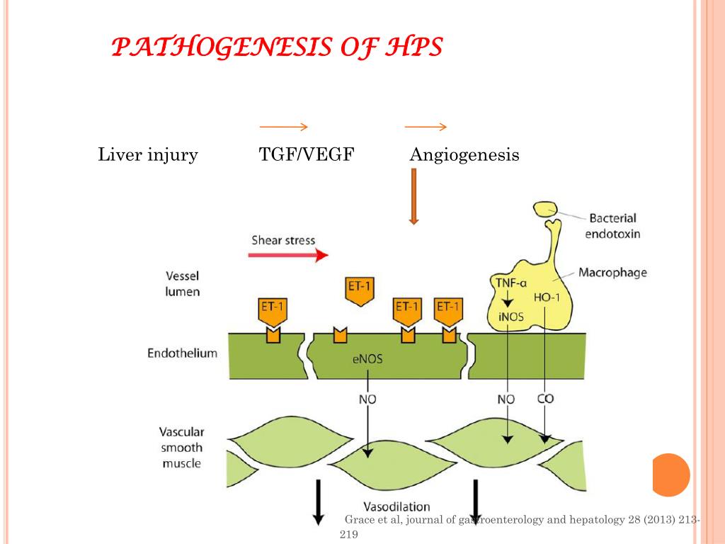 PPT - Hepatopulmonary syndrome and cirrhotic cardiomyopathy PowerPoint ...