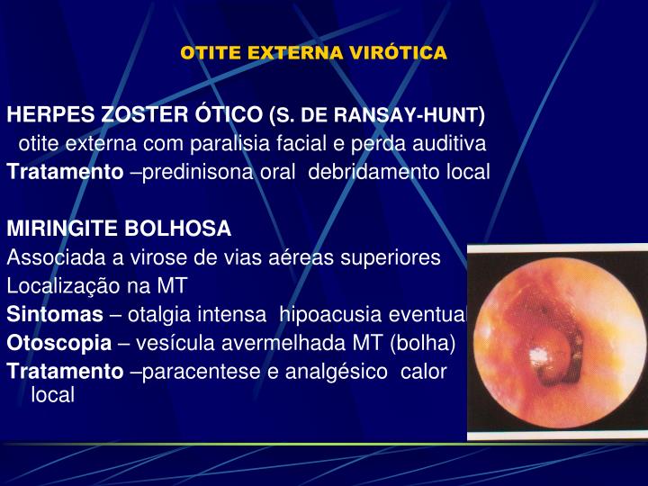 PPT - DOENÇAS DO APARELHO AUDITIVO PowerPoint Presentation - ID:1972843