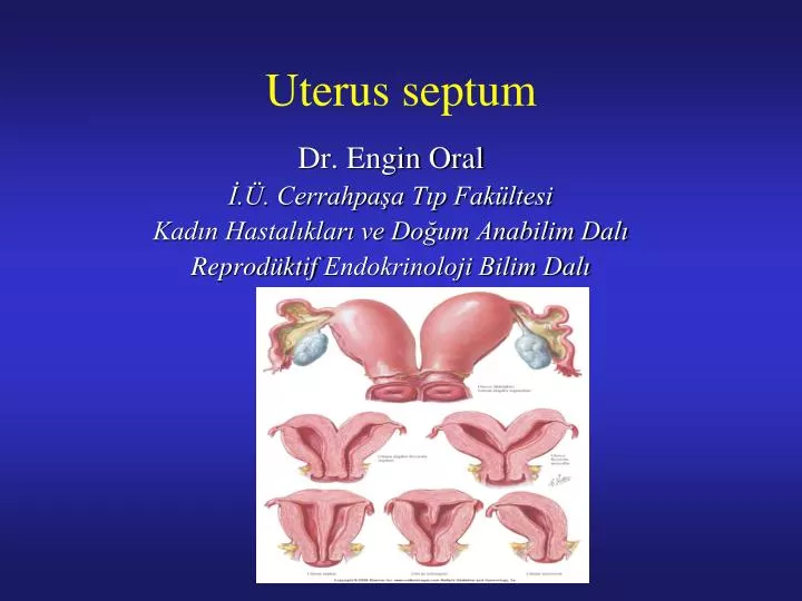 Types Of Uterine Septum at Sandra Santos blog