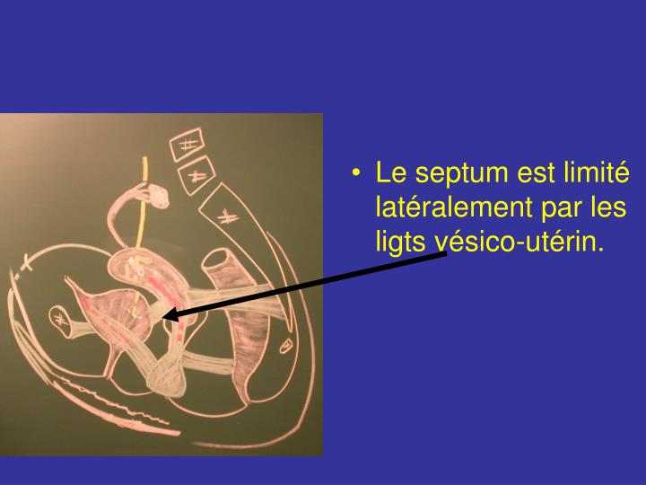 PPT - UTERUS NON GRAVIDE PowerPoint Presentation - ID:1973029