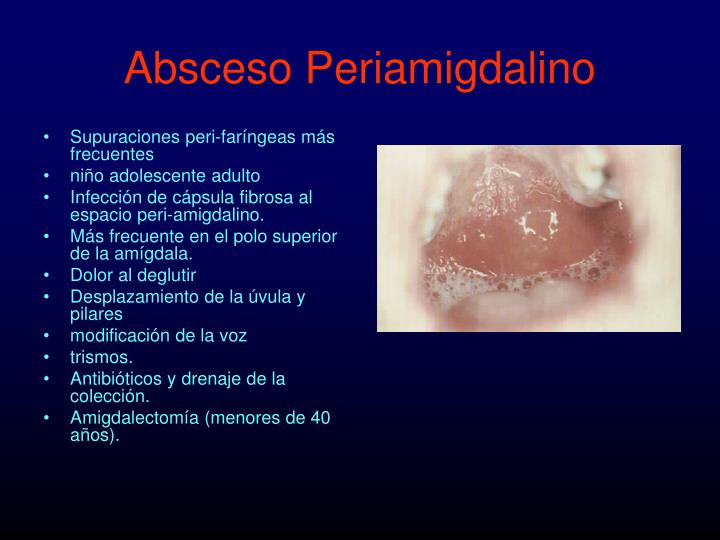 PPT - PATOLOGIA faringo-lar í ngea PowerPoint Presentation - ID:1973333