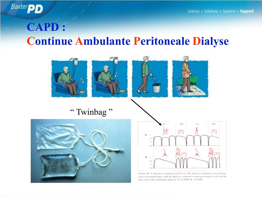 PPT - Basisbegrippen Peritoneale Dialyse AZ St-Jan Brugge 17 september ...