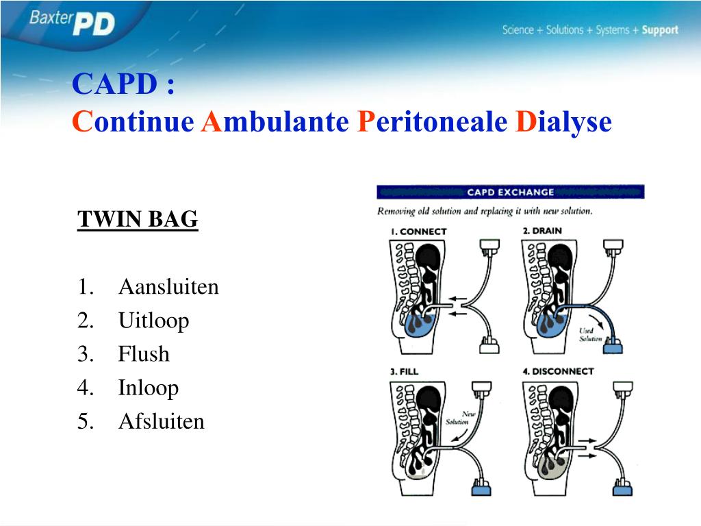 PPT - Basisbegrippen Peritoneale Dialyse AZ St-Jan Brugge 17 september ...