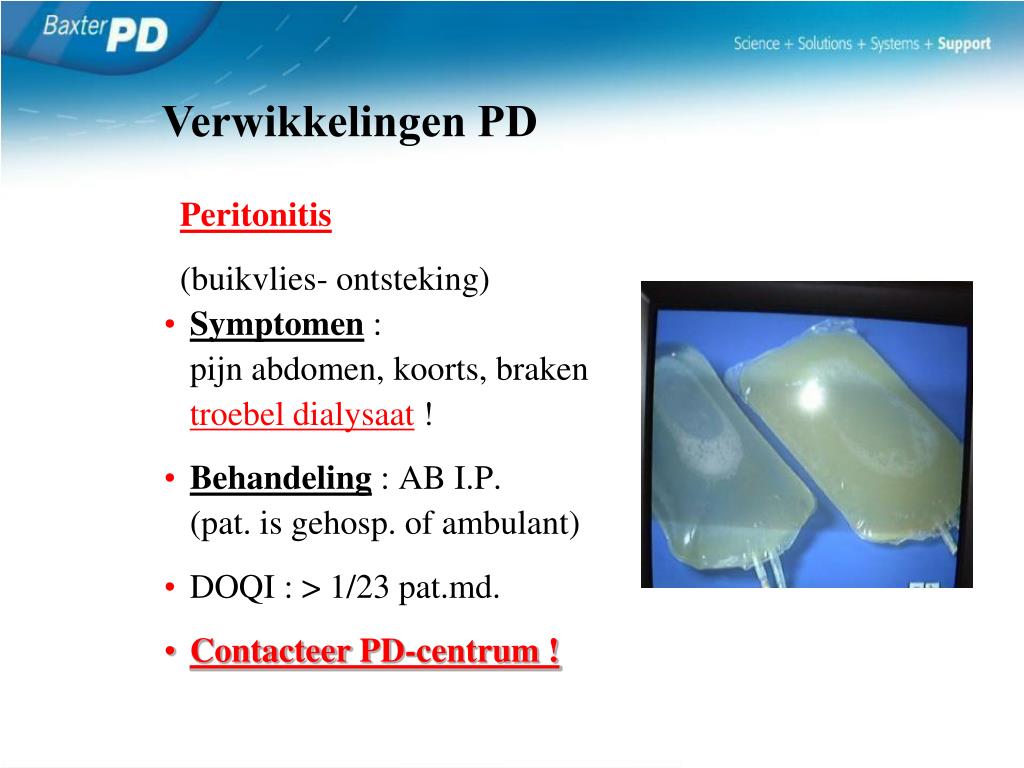 PPT - Basisbegrippen Peritoneale Dialyse AZ St-Jan Brugge 17 september ...