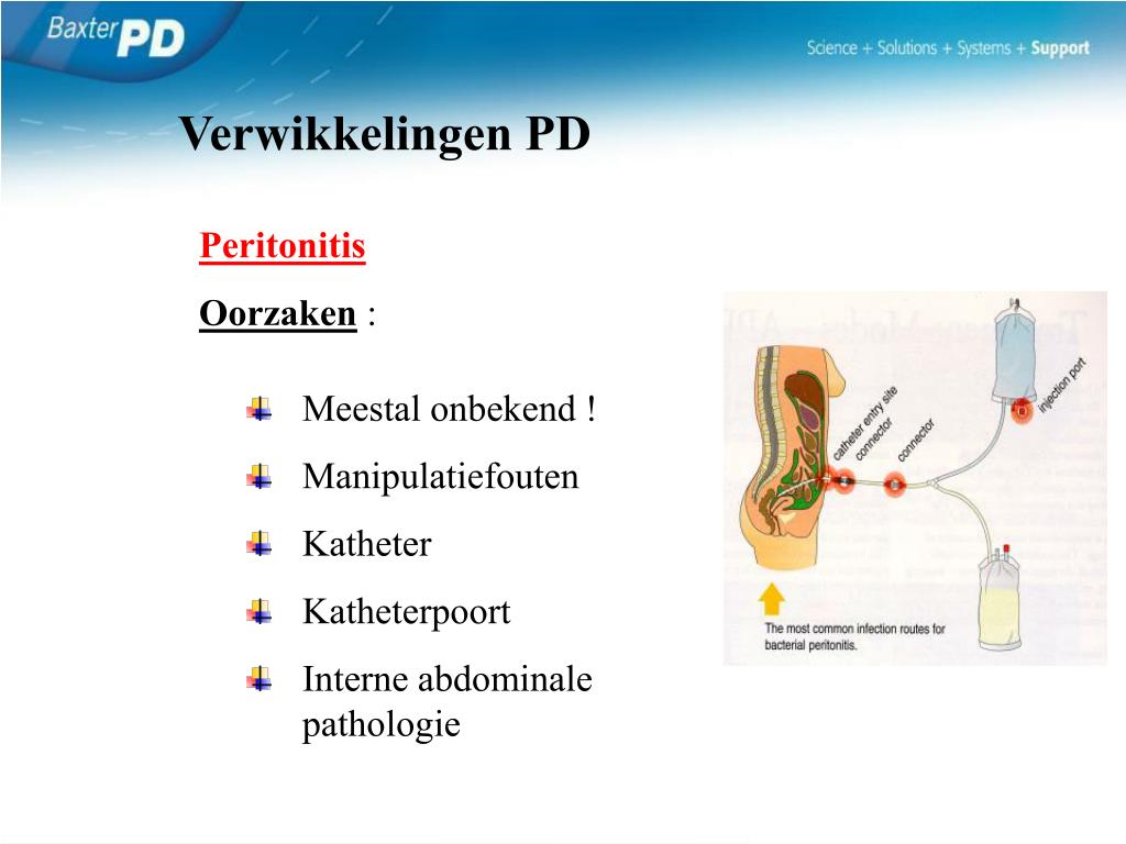 PPT - Basisbegrippen Peritoneale Dialyse AZ St-Jan Brugge 17 september ...