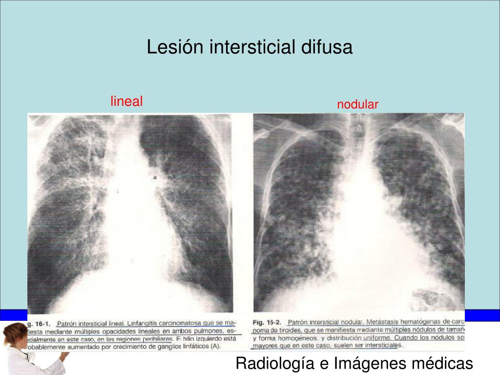 PPT - Universidad de Iberoamérica Facultad de Medicina Bachillerato ...