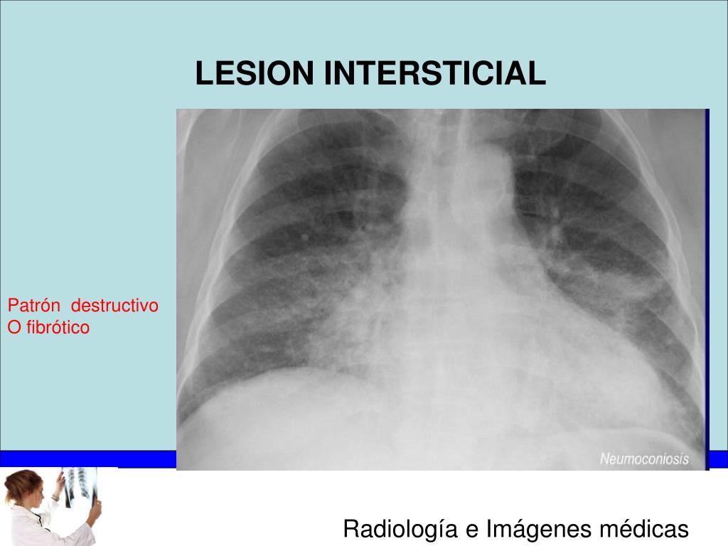PPT - Universidad de Iberoamérica Facultad de Medicina Bachillerato ...