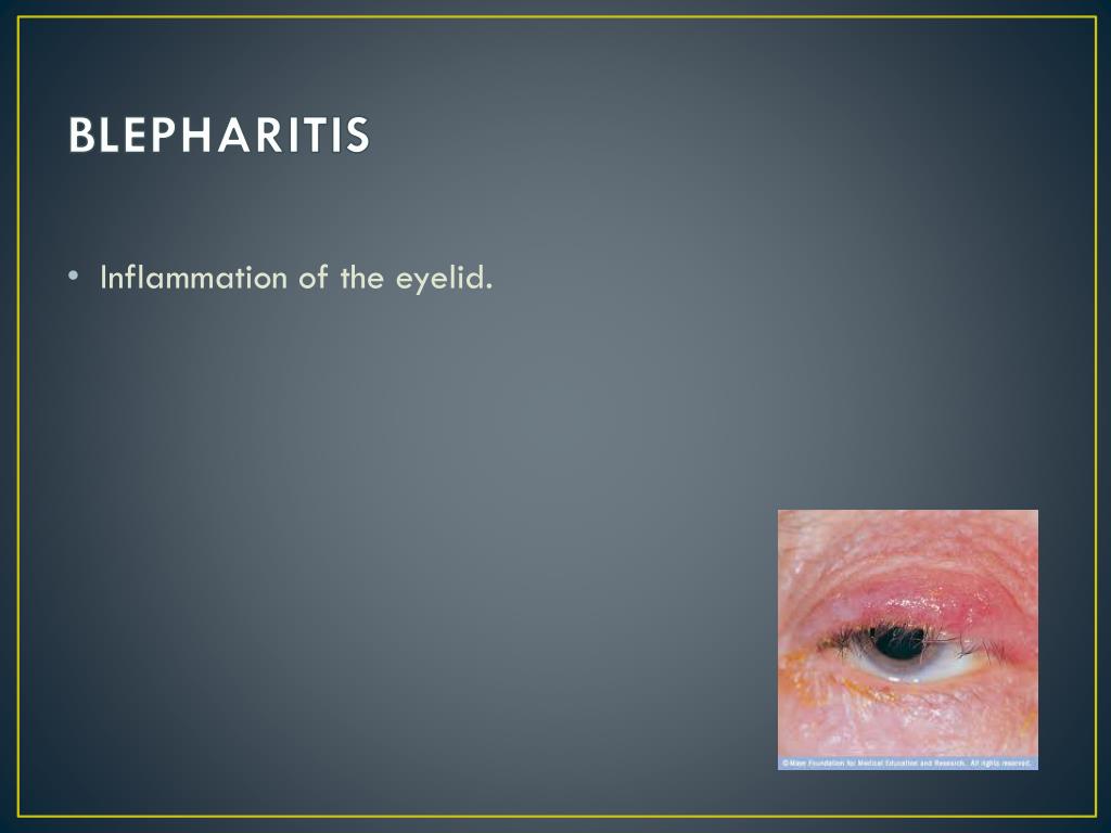 PPT - MEDICAL TERMINOLOGY RELATED TO SPECIAL SENSES PowerPoint ...
