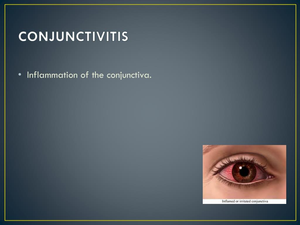 PPT - MEDICAL TERMINOLOGY RELATED TO SPECIAL SENSES PowerPoint ...