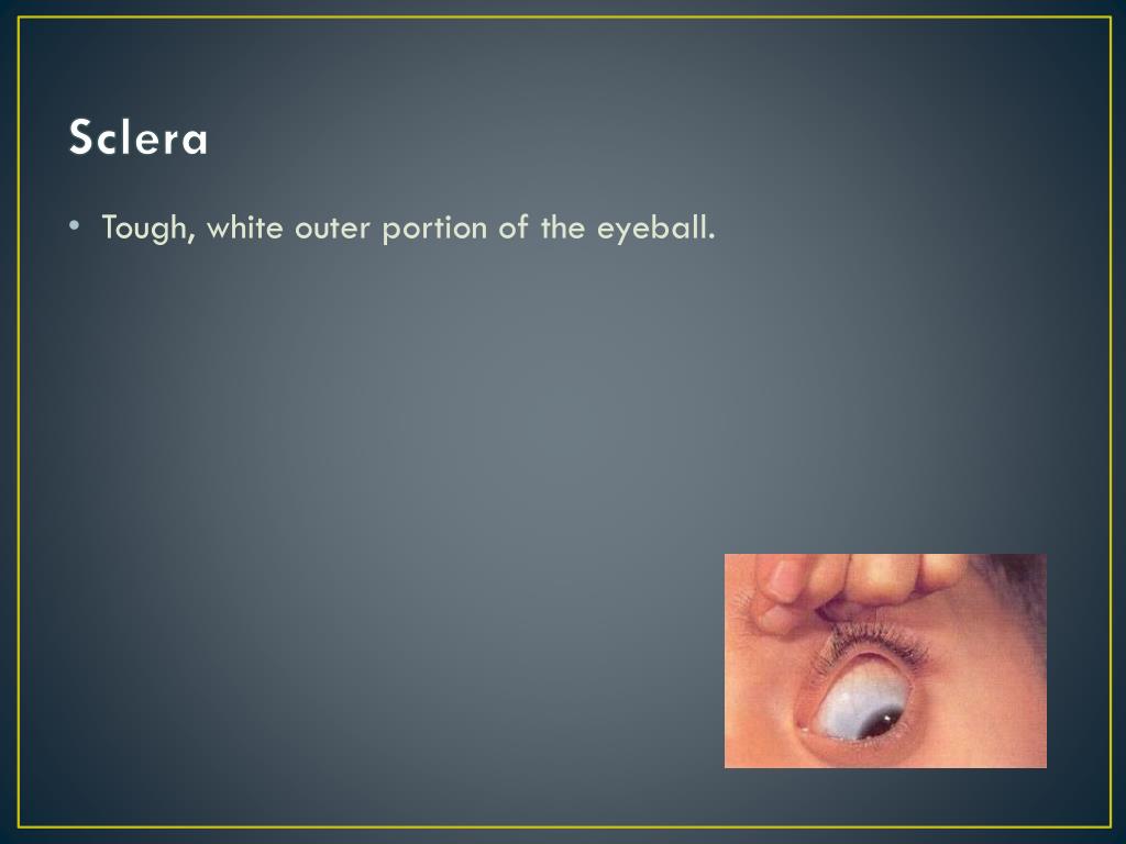 PPT - MEDICAL TERMINOLOGY RELATED TO SPECIAL SENSES PowerPoint ...
